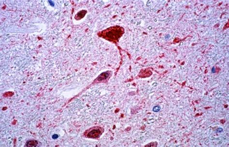 Imagen Gratis Ultraestructural La Morfología El Virus Nipah