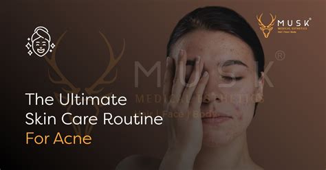 The Ultimate Skin Care Routine For Acne