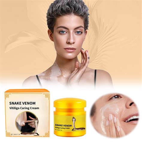 Skin Care Discomfort On Hands And Feet Nourishes And Cares For The Skin