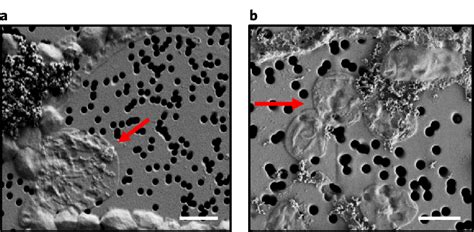Scanning Electron Micrographs Sem Of Group 2 Marsarchaeota A B