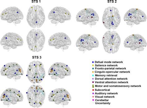 Differences In Functional Connectivity Of Informative Spatio Temporal