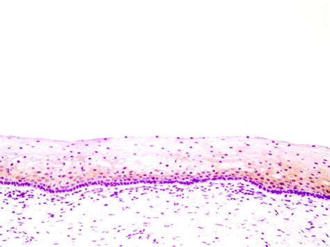 Pathology Outlines Histology