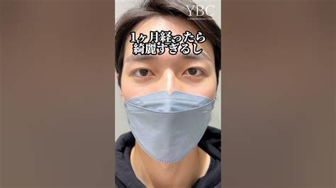 クマ取りしたらマジで後悔した Shorts Youtube