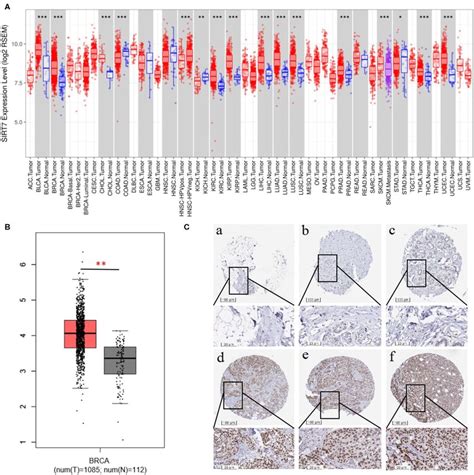 A Human Sirtuin Sirt 7 Expression Levels In Different Tumor Types