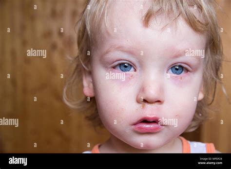 Krankheit Leiden Fotos Und Bildmaterial In Hoher Auflösung Alamy