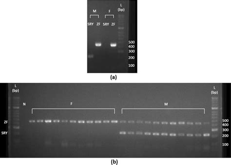 Amplification Of The Sex Identification Region Y Sry And Zinc Finger