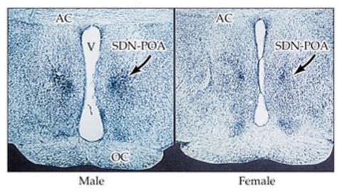 Sex Determination And Differentiation Flashcards Quizlet