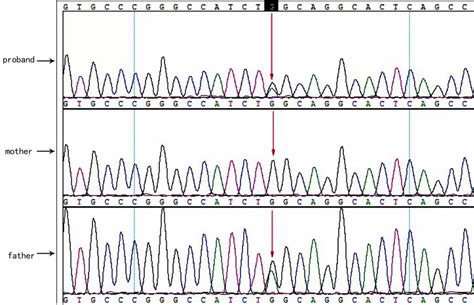 Figure E Abccc Gene C G A Mutated Sequence In The Proband Arrows