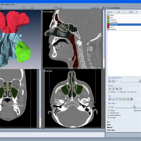 Pdf 3d Reconstruction Of Individual Anatomy From Medical Image Data