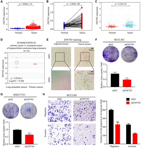 Znf765 Is A Prognostic Biomarker Of Hepatocellular Carcinoma Associated