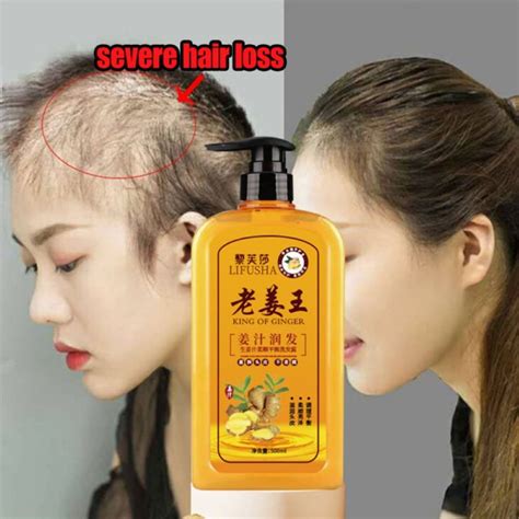 500ml Ginger Hair Shampoo Fast Regrowth Hair Thick Shampoo Anti Hair
