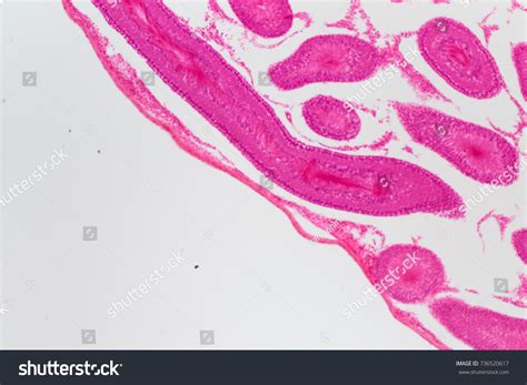 Cross Section Human Testis Under Microscope Foto De Stock 736520617