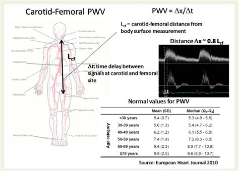 Measurement Of Carotid Femoral Pwv Currently Considered As A Reference