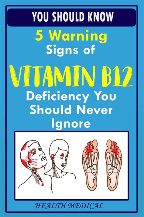5 Warning Signs Of Vitamin B12 Deficiency You Should Never Ignore Artofit