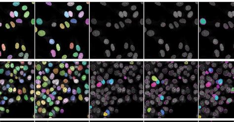 A Deep Learning Pipeline For Nucleus Segmentation Frederick National