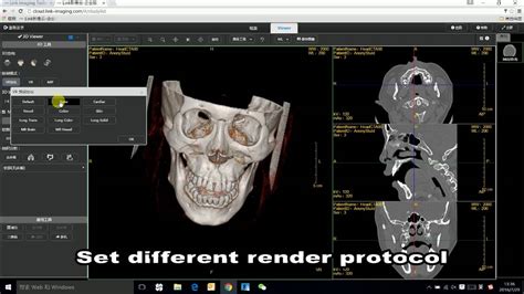 linkcloud web 3d dicom viewer youtube
