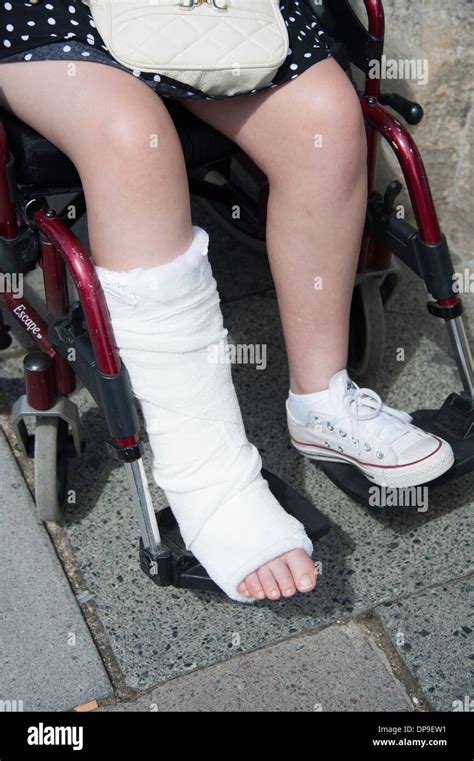 Jeune Fille Avec Fracture De La Cheville Dans Le Plâtre Modèle