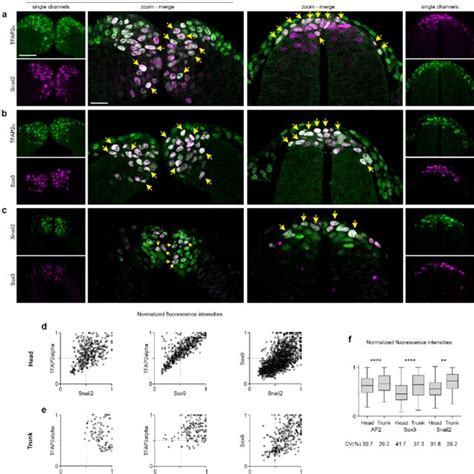 Differential Heterogeneity Of Cephalic And Trunk Neural Crest Cells