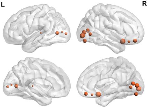 Frontiers The Body Mass Index Is Associated With Increased Temporal