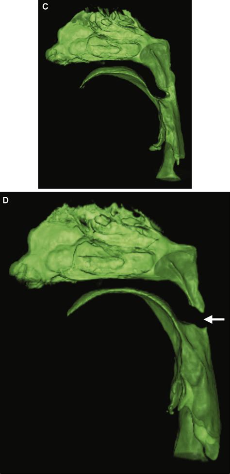 Computed Tomography Characterization And Comparison With
