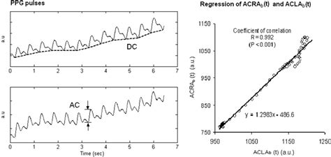 A Typical Ppg Trace With Dc And Ac Components Identified B Highly