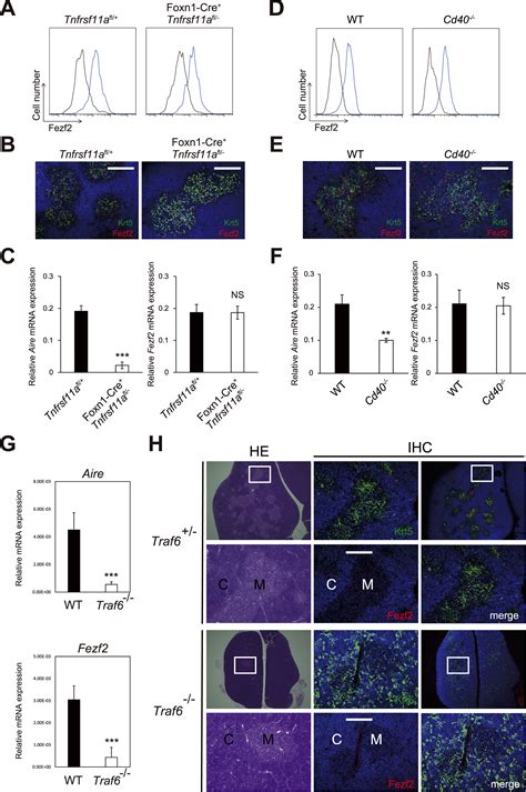 Fezf2 Orchestrates A Thymic Program Of Self Antigen Expression For