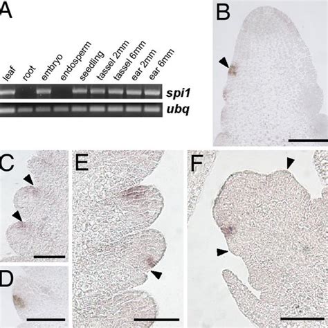 Spi1 Expression Analysis A Spi1 Qualitative Rt Pcr In Different