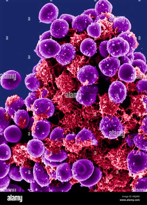 Staphylococcus Epidermis Epidermidi