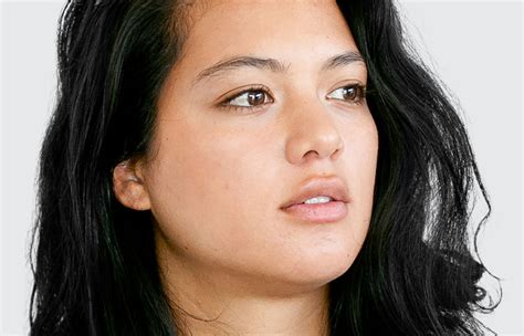 Can Microneedling Morpheus Be Done On Breast Implant Scar