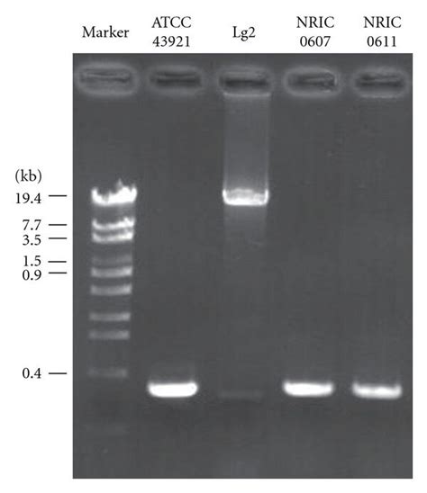 Expression Of The Capsule Gene Cluster In L Garvieae Strains Isolated