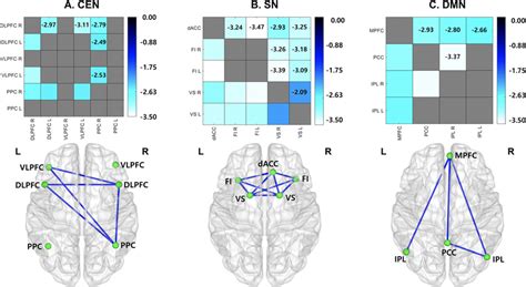 Group Differences Of Functional Connectivity Igd Individuals Showed
