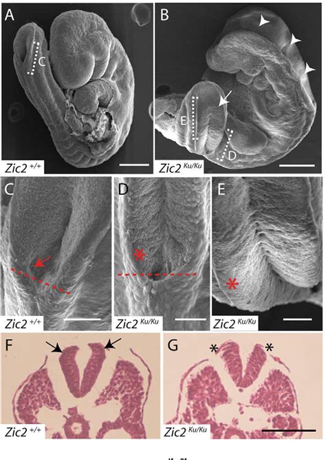 Figure 1 From Neural Plate Morphogenesis During Mouse Neurulation Is