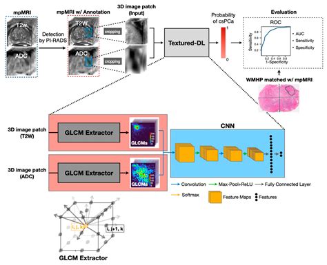 Diagnostics Free Full Text Textured Based Deep Learning In Prostate