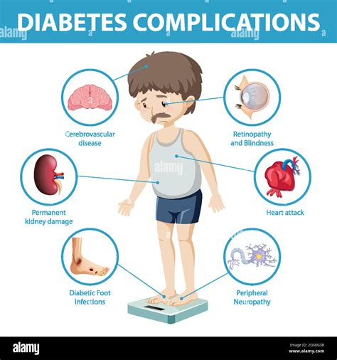 Infografía Informativa Sobre Complicaciones De La Diabetes Imagen
