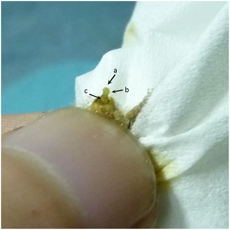 excision of h armigera sex pheromone gland for being extractioned a