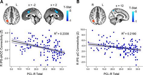Altered Resting State Functional Connectivity In Cortical Networks In