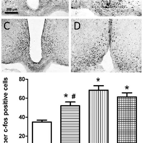 C Fos Immunoreactivity In The Arcuate Nucleus Arc Two Hrs After Icv