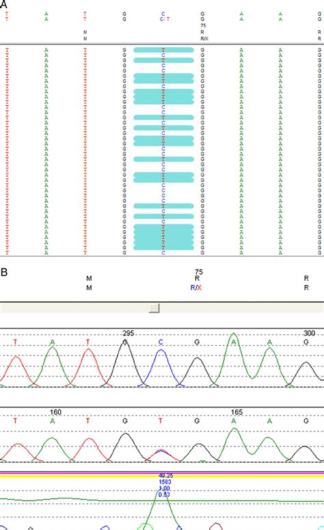 Example Of A Pathogenic Mutation Identified In Max C [223c Ͼ T] [ ϭ