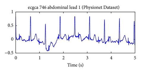 Ecgca 746 Abdomen Lead 1 Noninvasive Fetal Ecg Database Physionet