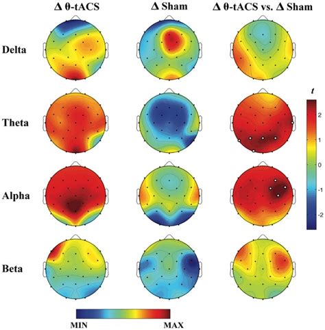 Bilateral 5 Hz Transcranial Alternating Current Stimulation On Fronto