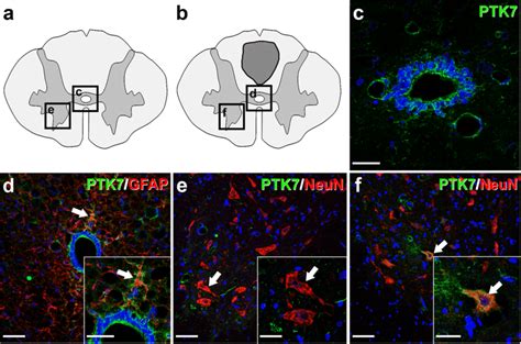 Spatio Temporal Expression Pattern Of Ptk7 In The Ependymal Epithelium
