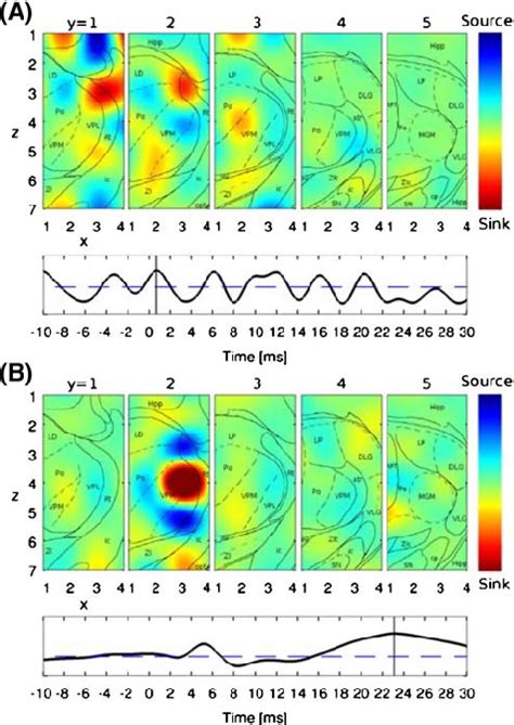 Examples Of Components Typically Obtained With Temporal And Spatial Ica