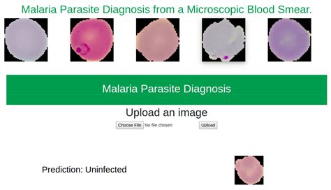 Diagnostics Free Full Text Deep Learning Based Automatic Malaria
