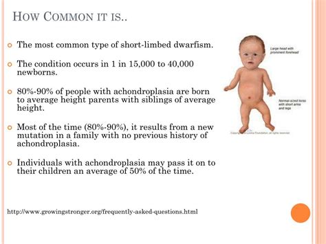 Ppt Achondroplasia Powerpoint Presentation Free Download Id 6261505