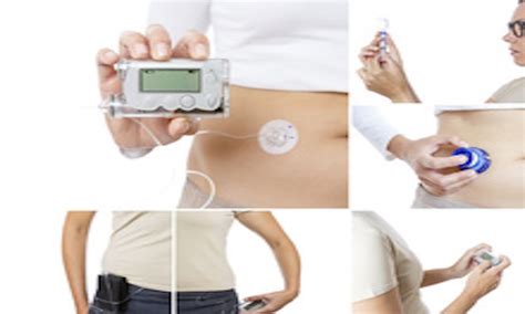 Omnipod 5 Effective At Glycemic Control Across Spectrum Of Insulin