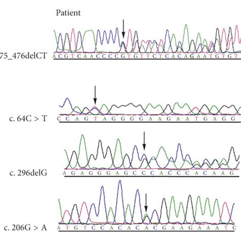 Sequencing Analysis Of Four Pitx2 Affected Patients With Ars The