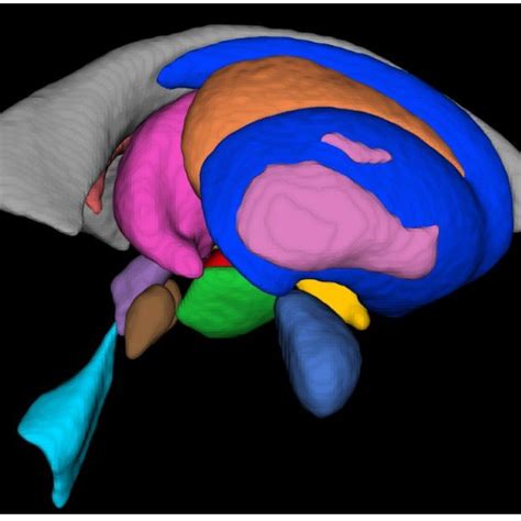 The 17 Subcortical Structures Currently Included In The Parcellation