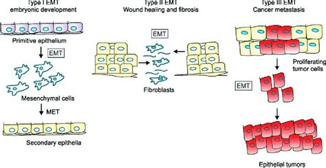 Three Types Of Epithelial–mesenchymal Transition Emt Type I Emt Is