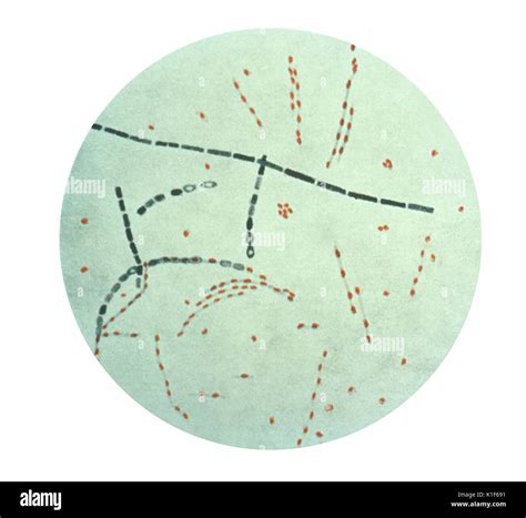 Bacillus Anthracis From Agar Culture Photomicrograph Of Bacillus