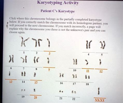 Solved Karyotyping Activity Patient Cs Karyotype Click Where This